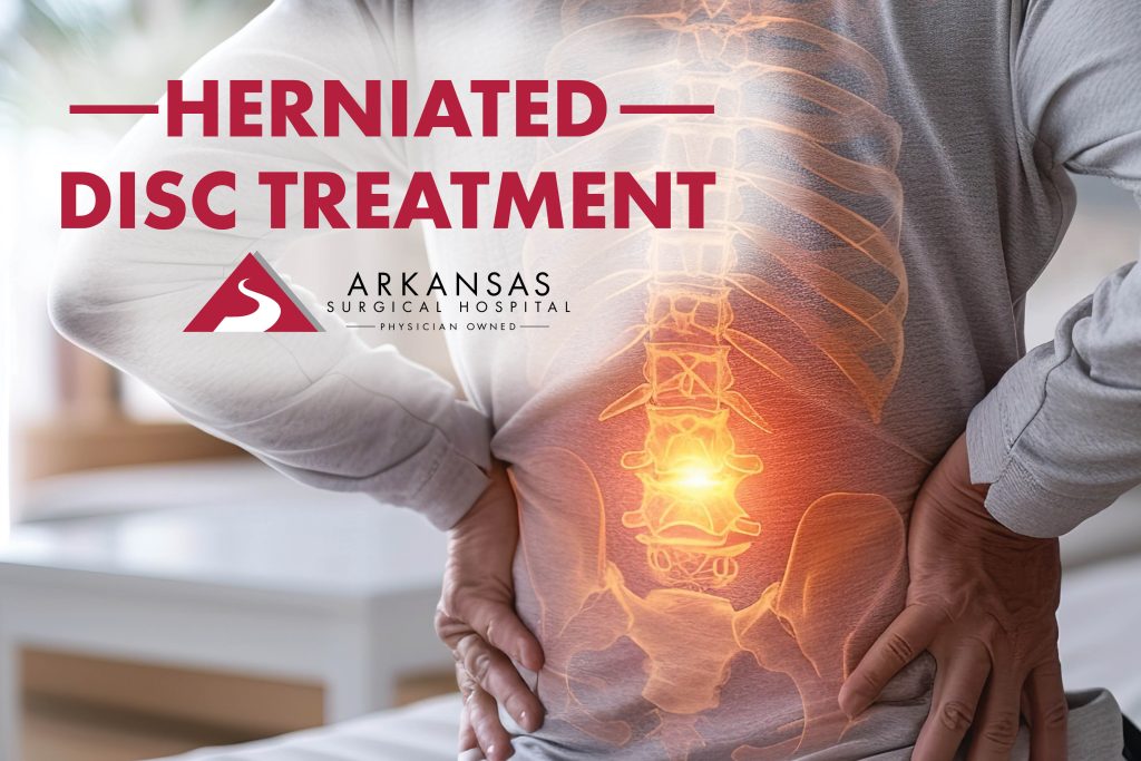 Herniated Disc Treatment Arkansas Surgical Hospital 7241